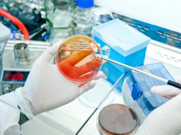 Cultivation of E. coli Engineered Bacteria for Degradation of Organic ...